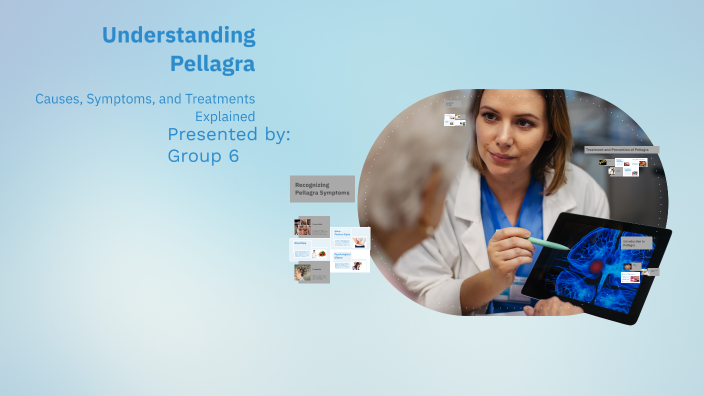 Understanding Pellagra by Chloe jo Cabrera on Prezi