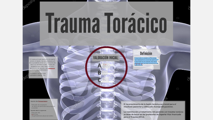 Trauma Torácico by Marcela Garza on Prezi