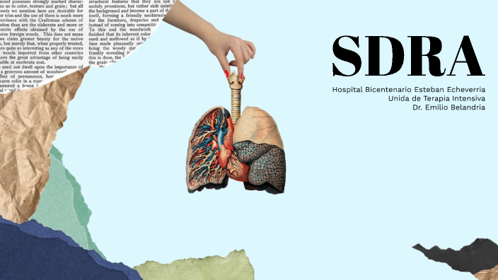 SDRA by emilio belandria on Prezi