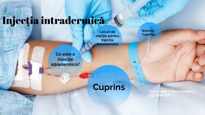 Injecție intradermică by Boțan Mădălina on Prezi