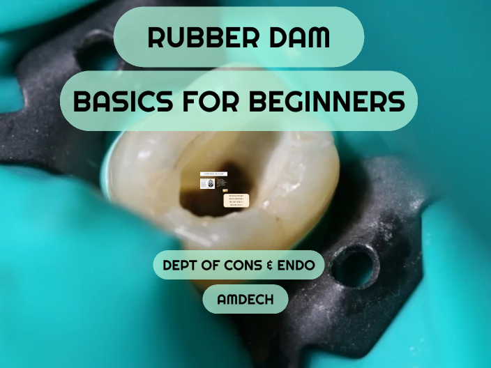 RUBBER DAM by yohan chacko on Prezi