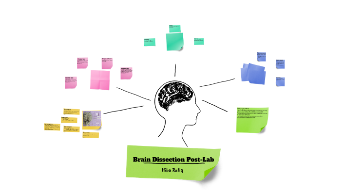 Brain Dissection post-lab by Hiba Rafiq on Prezi