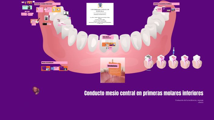 Conducto mesio central en primeras molares inferiores by Rocio Julieth ...