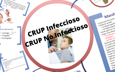 CRUP infeccioso y No infeccioso by Heber Moran on Prezi