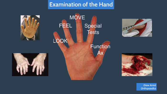 Examination of the Hand by Drew Armit on Prezi
