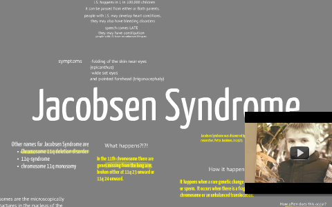 jacobsen syndrom by brooke whatley on Prezi