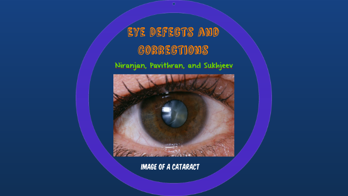Eye Defects and Corrections by Niranjan K on Prezi