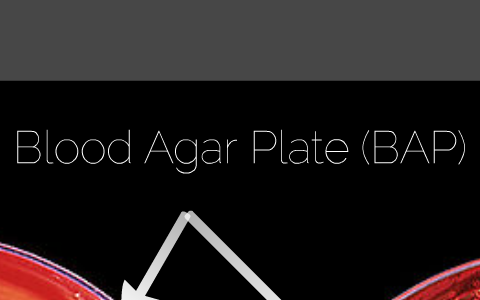 Blood Agar Plate (BAP) by Gregory Nicolas on Prezi