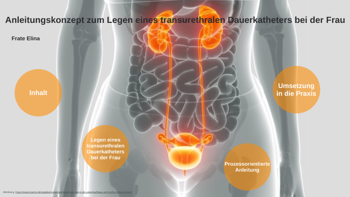 Anleitungskonzept zum Legen eines transurethralen Dauerkatheters bei ...
