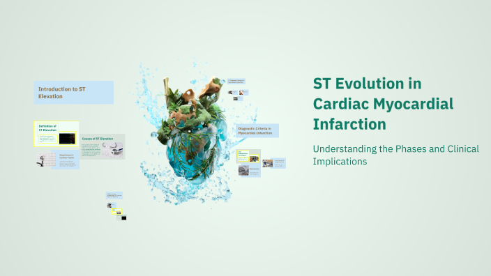 ST Evolution in Cardiac Myocardial Infarction by Ali Shahsavari on Prezi