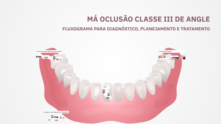 MÁ OCLUSÃO CLASSE III DE ANGLE by Jave gamer on Prezi