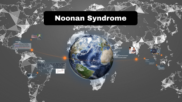 NOONAN SYNDROME by Rohit Yadav on Prezi