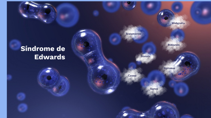 Síndrome de Edwars by Paula Espárrago Martínez on Prezi