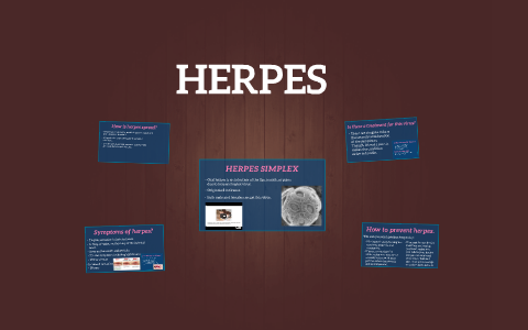 Herpes project by Alex T on Prezi