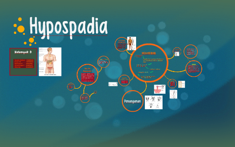 Hypospadia by Ibtichal Putri on Prezi