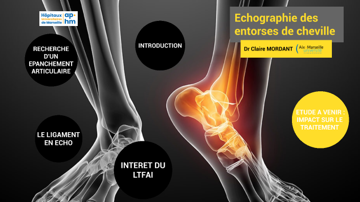 Echographie des entorses de cheville by Clément Paul on Prezi