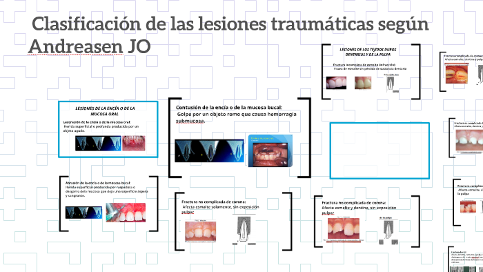 Clasificación de las lesiones traumáticas según Andreasen J by Fernando ...