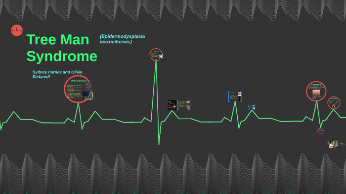 Tree Man Syndrome by Sydney Carnes on Prezi