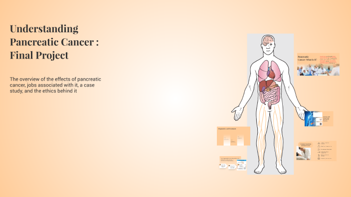 Understanding Pancreatic Cancer: A Comprehensive Overview by Ahmelia ...