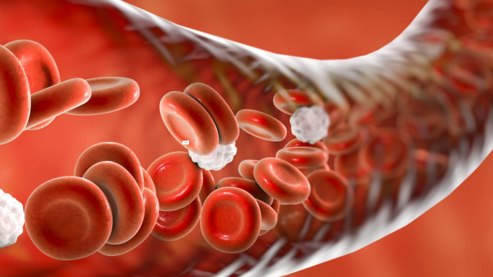 Hemocromatosis by Tania Cebrian Ruano on Prezi