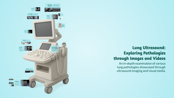 Lung Ultrasound: Exploring Pathologies through Images and Videos by ...