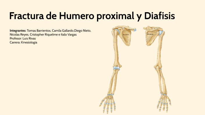 FX DE HUMERO PROXIMAL Y DIAFISIS by Italo Vargas on Prezi