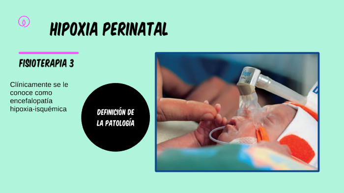 HIPOXIA PERINATAL by fernanda vazquez on Prezi