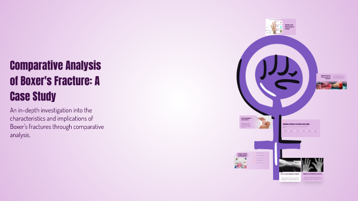 Comparative Analysis of Boxer's Fracture: A Case Study by Tatiyana ...