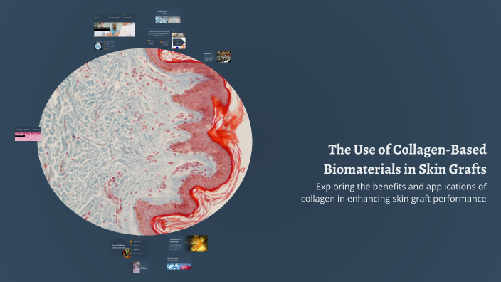 The Use of Collagen-Based Biomaterials in Skin Grafts by Euneiro ...