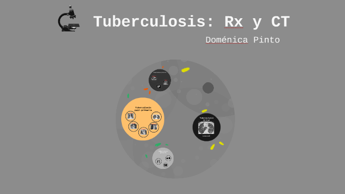 Tuberculosis: Rx y CT by Domenica Pinto on Prezi