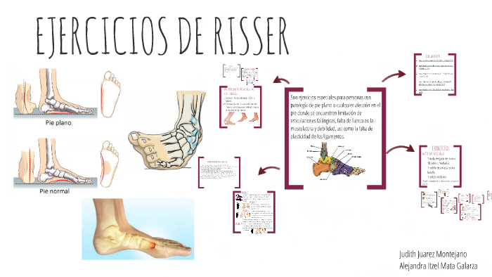 EJERCICIOS DE RISSER by Alejandra Galarza on Prezi
