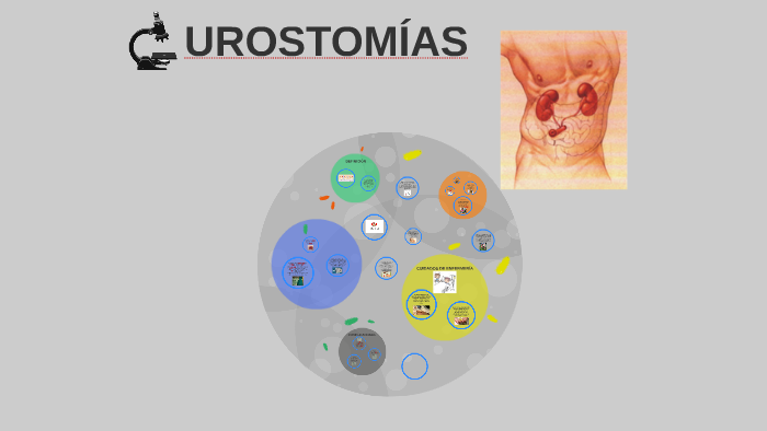 UROSTOMIAS by Claudia Agudelo on Prezi