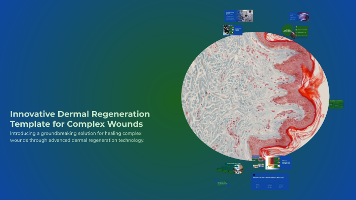Innovative Dermal Regeneration Template for Complex Wounds by Ryan ...