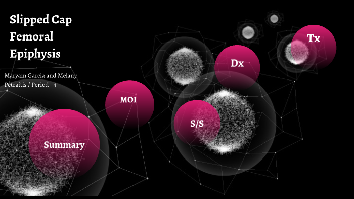 Slipped Cap Femoral Epiphysis by maryam garcia on Prezi