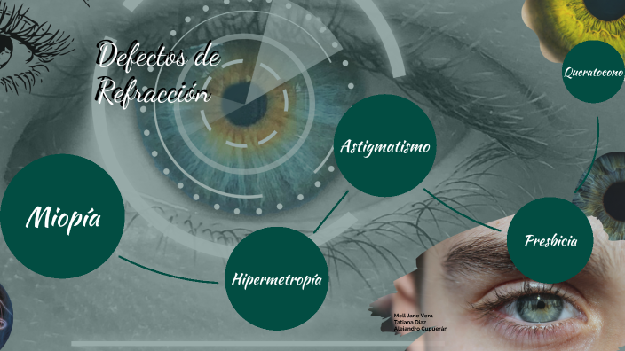 Defectos de Refracción by Jane Vera on Prezi