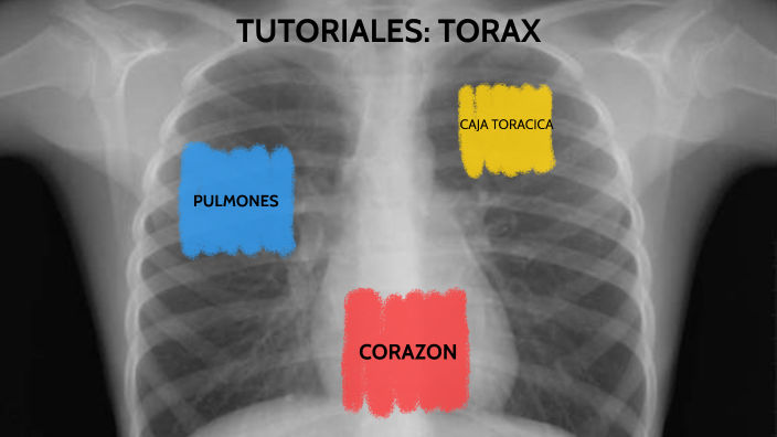 TORAX by Lucas Ezequiel Sosa on Prezi