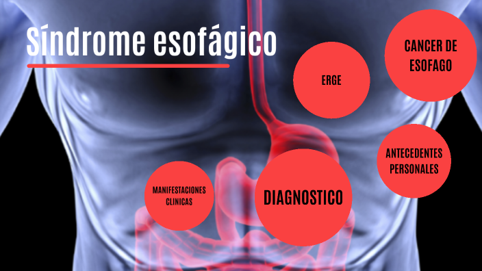 SINDROME ESOFAGICO by Andrea Talavera on Prezi