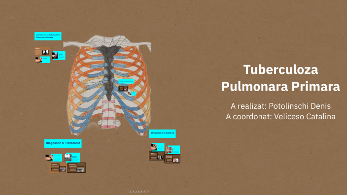 Tuberculoza Pulmonara Primara by Denis Potolinschi on Prezi