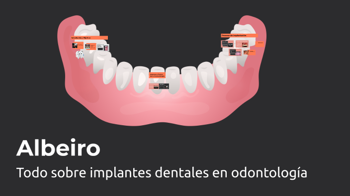 Implantología by Loida Amaya on Prezi