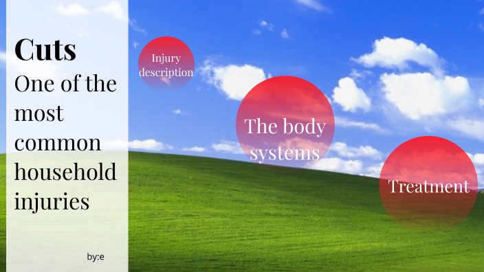 cut a very coman injury by Ezra Jancik on Prezi