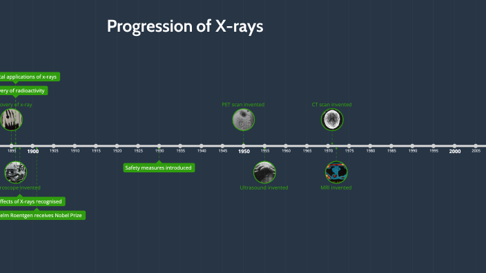 Progression of X-rays by on Prezi
