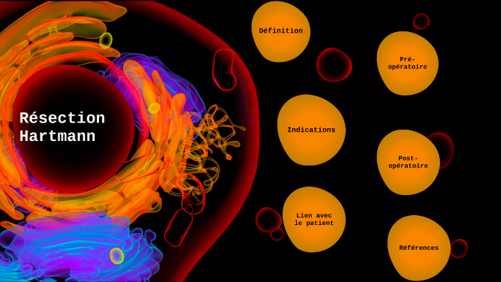 Résection Hartmann by Marine Dumas-Treyvaud on Prezi