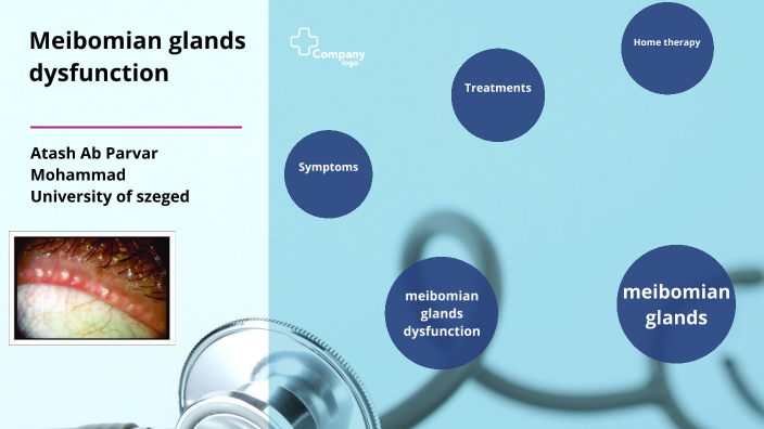 Meibomian glands dysfunction by Mohammad Atash Ab Parvar on Prezi