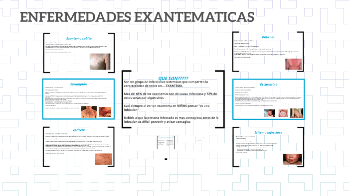 ENFERMEDADES EXANTEMATICAS by on Prezi