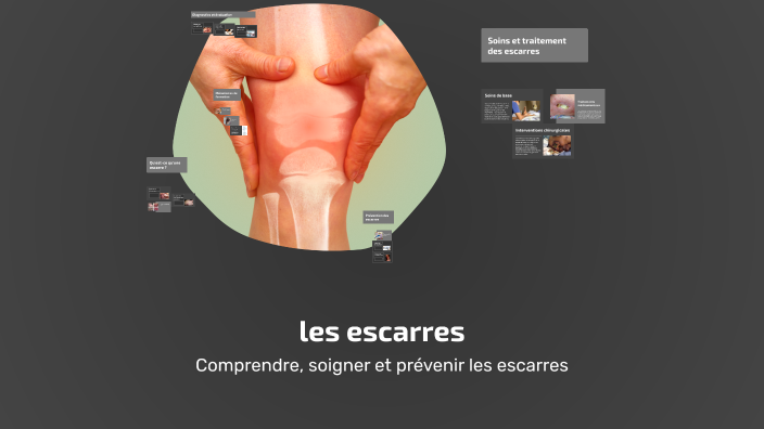 Comment prévenir les escarres by sarra el makrini on Prezi