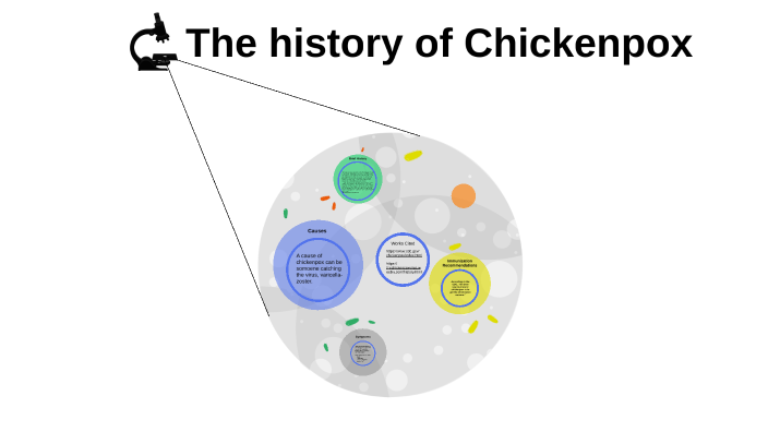 History of Chickenpox by Leslie Louissaint on Prezi