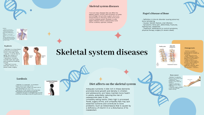 skeletal system diseases by Jana Yousef on Prezi