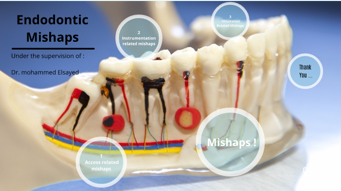 Endodontic Mishaps by aliaa ali on Prezi