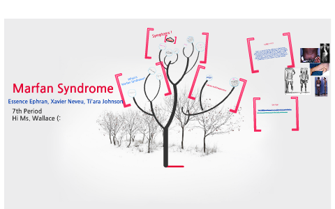 Anatomy: Marfan syndrome by Essence Ephran on Prezi