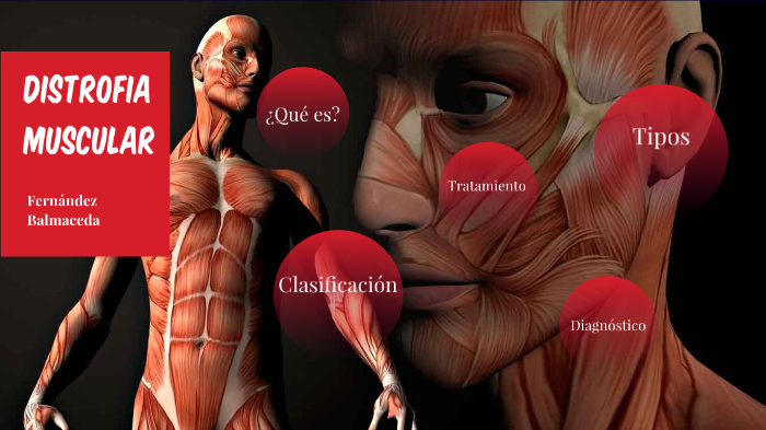 Distrofia Muscular by Soofi Fernandez on Prezi